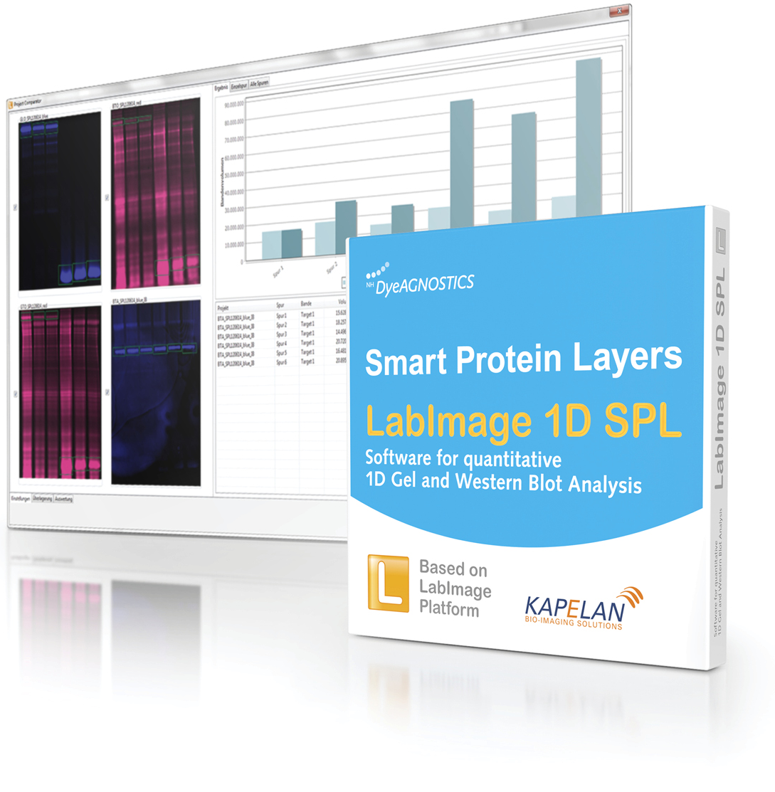 1D Gel & Blot Software - NH DyeAGNOSTICSNH DyeAGNOSTICS